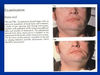 Examination, Diagnosis, Treatment Planing II | PPT