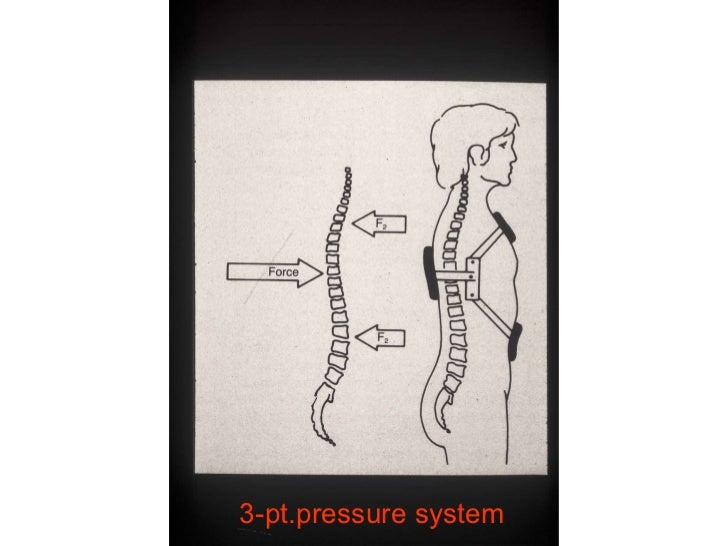 Slide รูปกายอุปกรณ์ spine & lower extremities 1