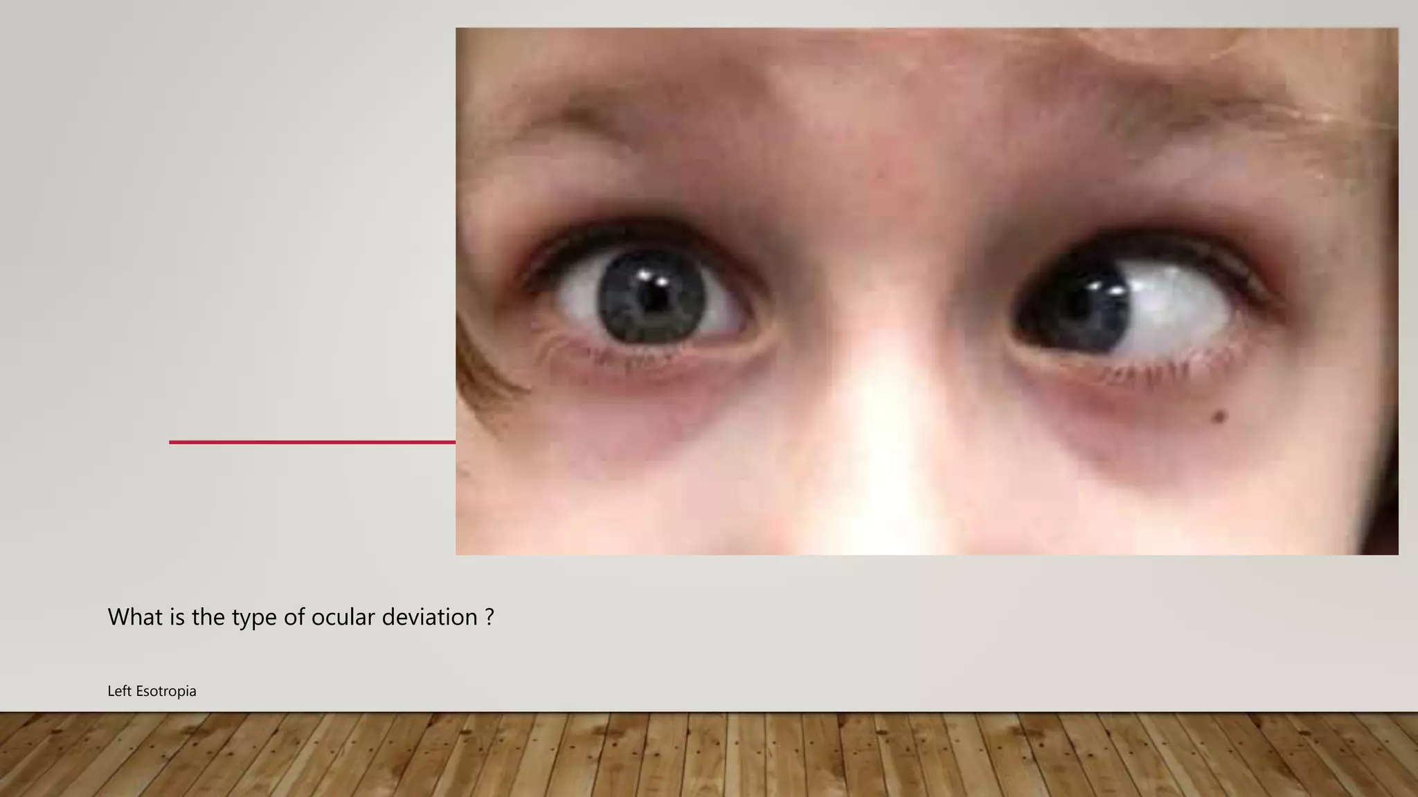 Ophthalmology Slides revision | PPTX