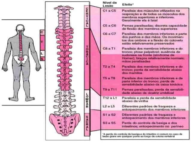 Slides trauma raquimedular
