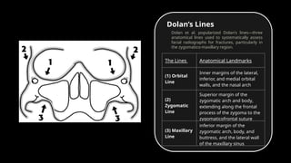 clinical use of waters projection in determining sinus problems | PPTX