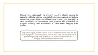 clinical use of waters projection in determining sinus problems | PPTX