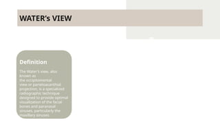 clinical use of waters projection in determining sinus problems | PPTX