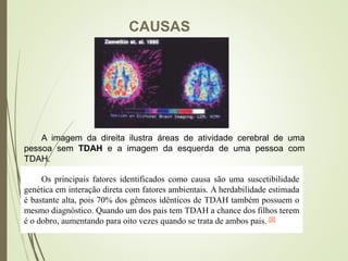 slide TDAH completo.ppt.pptx