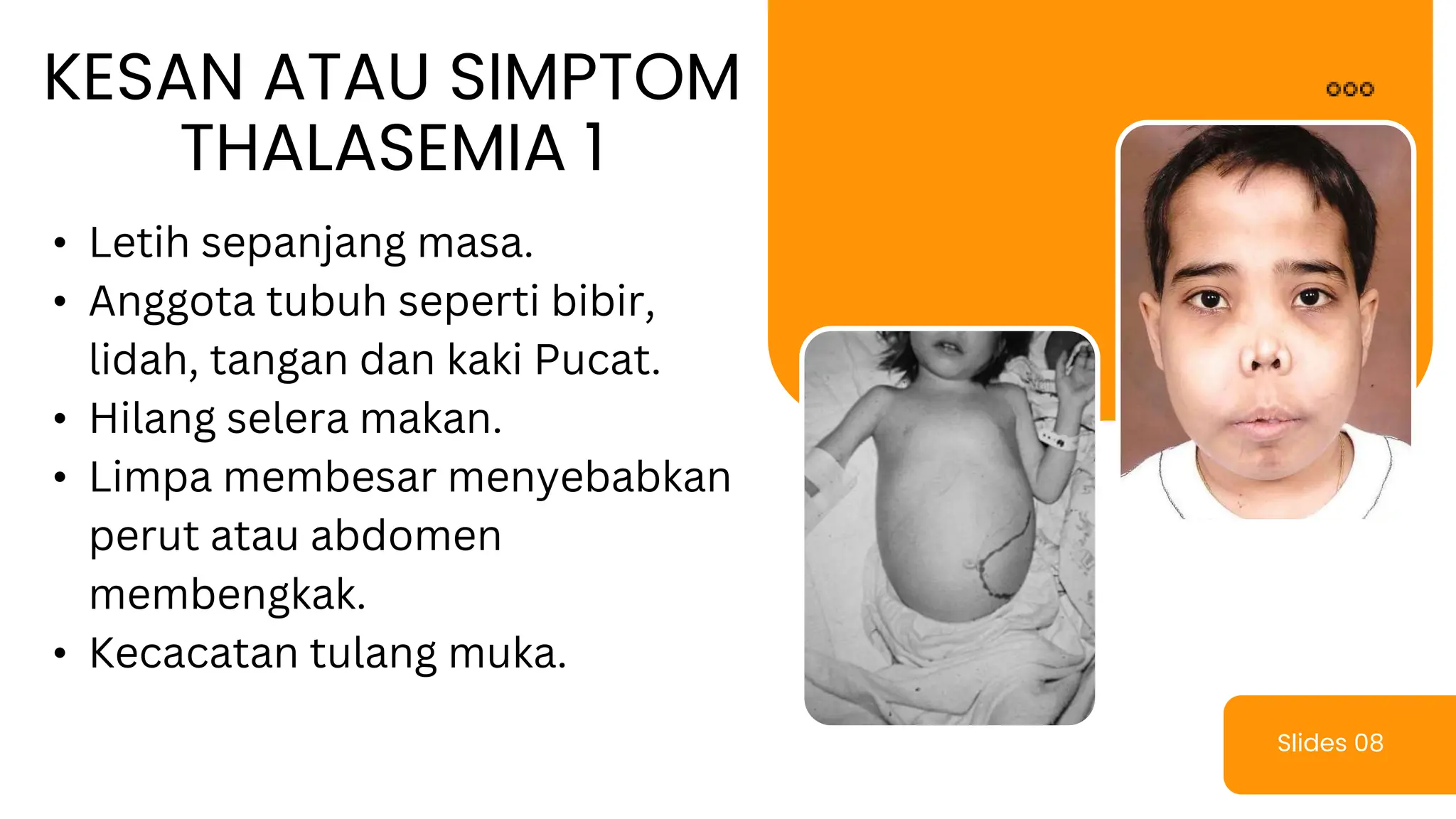 PENYAKIT THALASSEMIA DI MALAYSIA.pptx