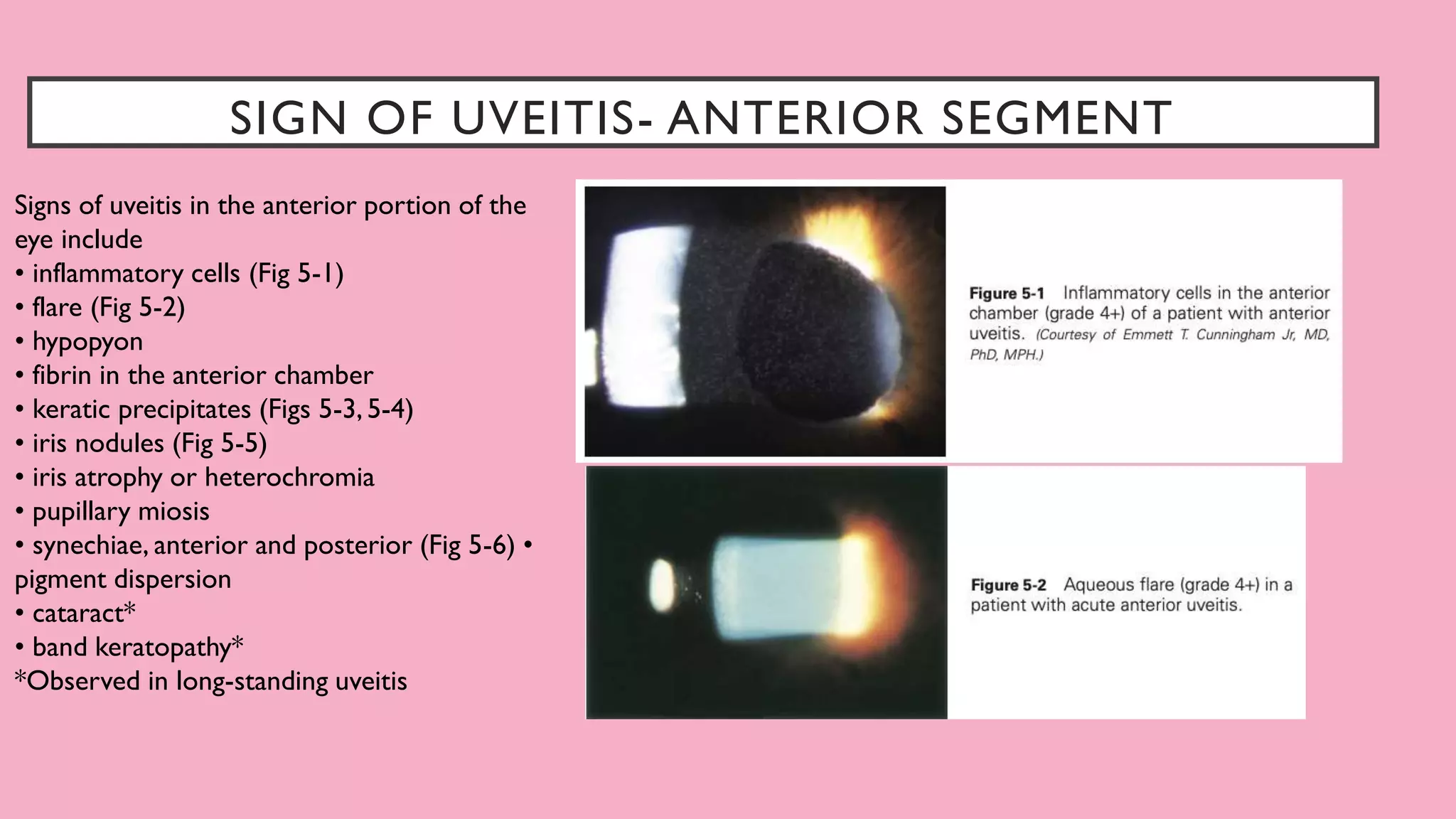 SLIDE UVEITIS ANTERIOR TO POSTERIOR .pptx