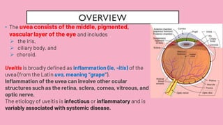 SLIDE UVEITIS ANTERIOR TO POSTERIOR .pptx | Eye and Vision Conditions ...