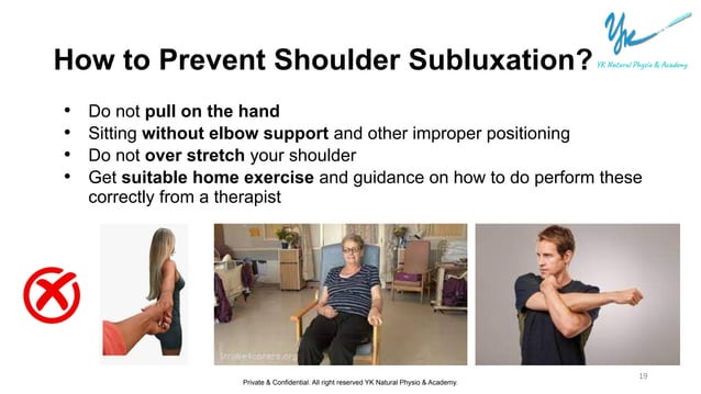 How to Prevent and Treat Shoulder Subluxation After Stroke?