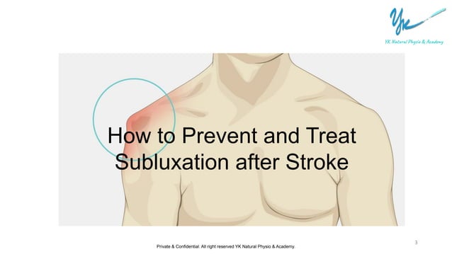 How to Prevent and Treat Shoulder Subluxation After Stroke?