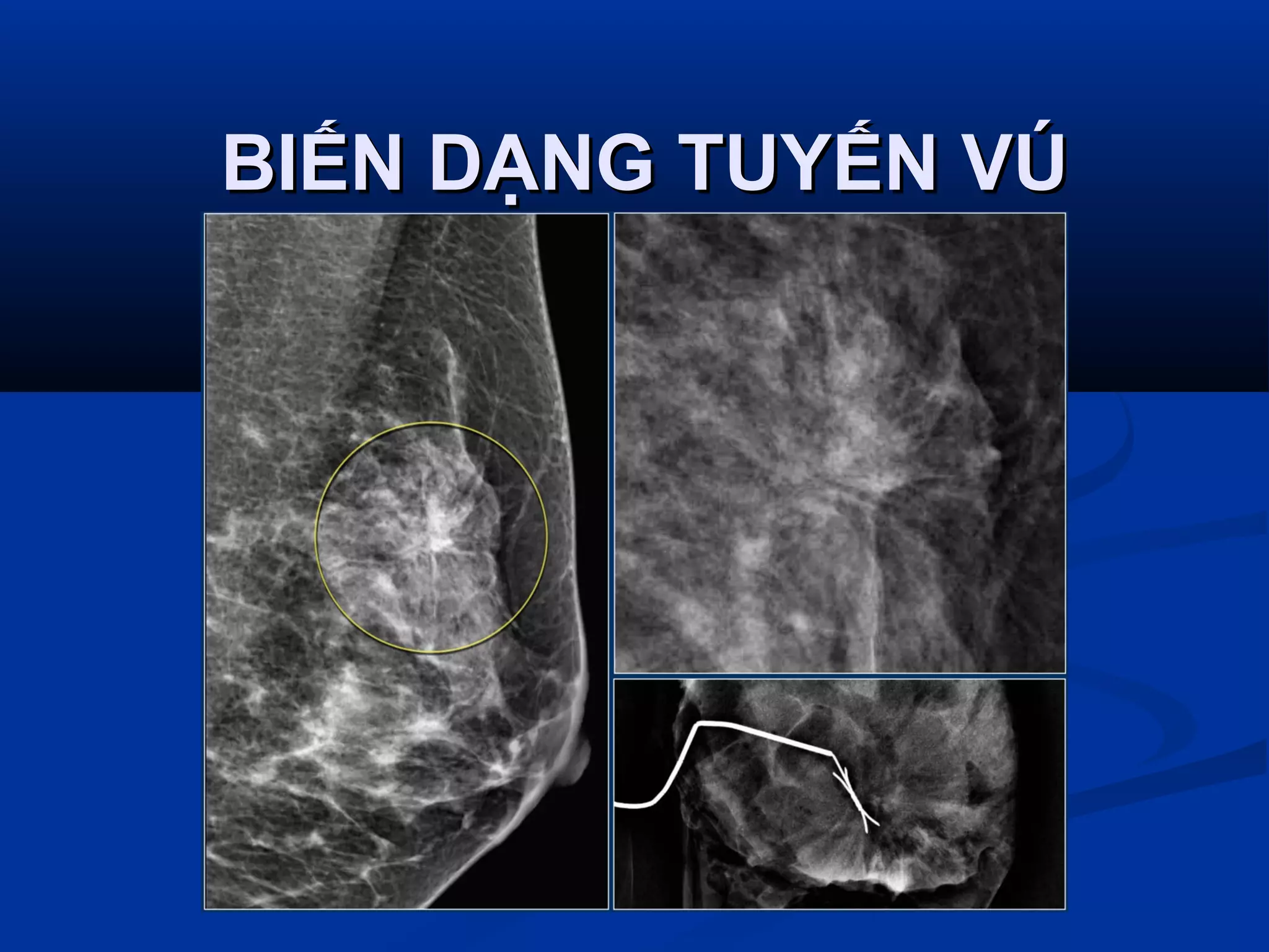 X QUANG TUYEN VU | PPT