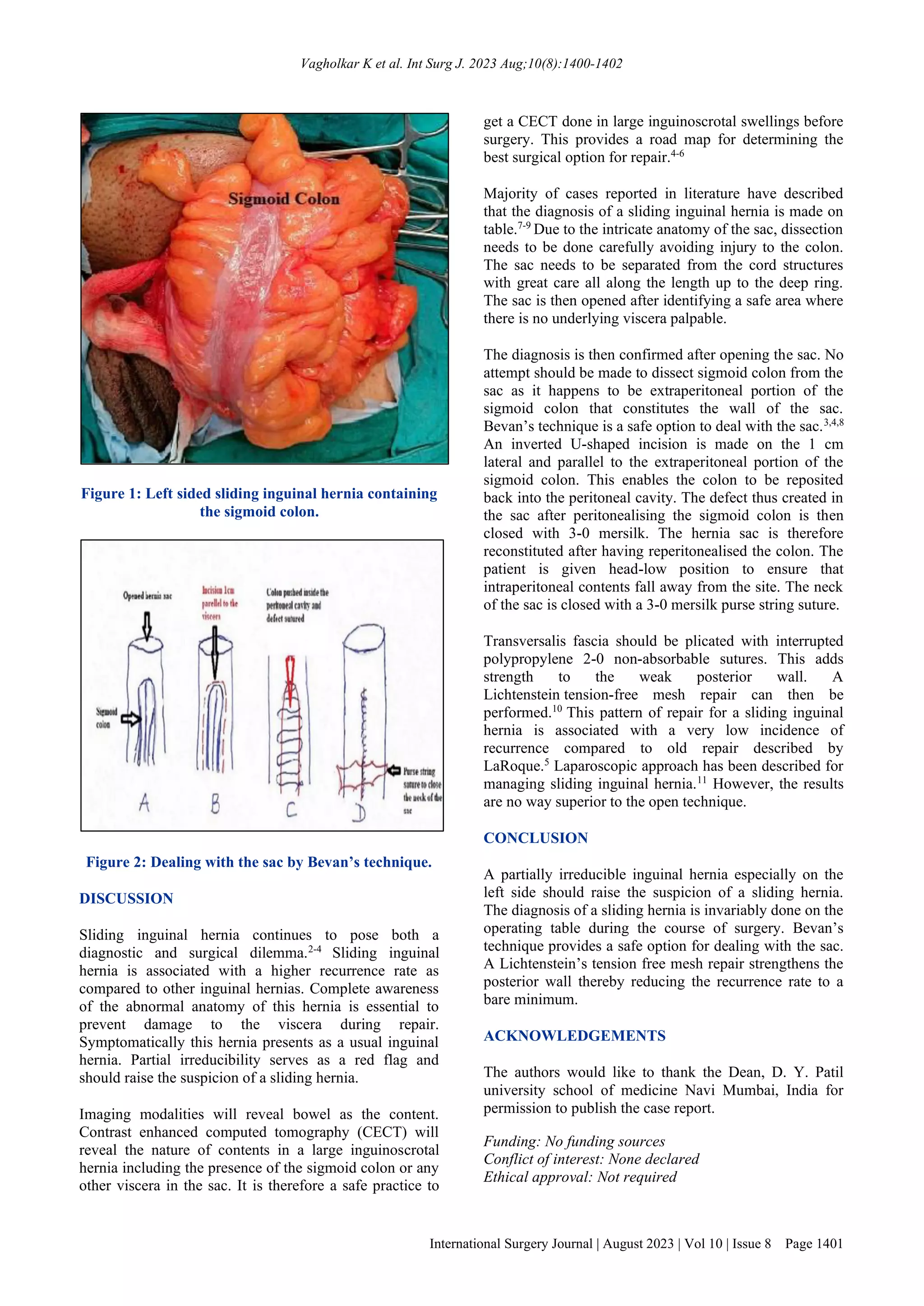 Sliding hernia.pdf
