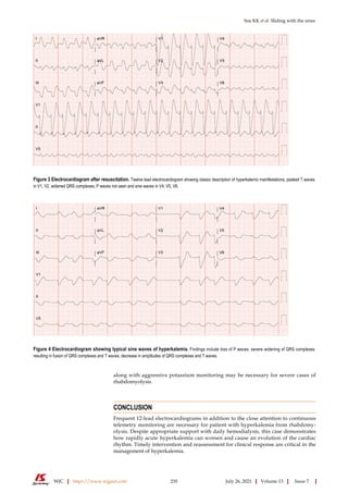 Sliding with the sines hyperkalemia | PDF