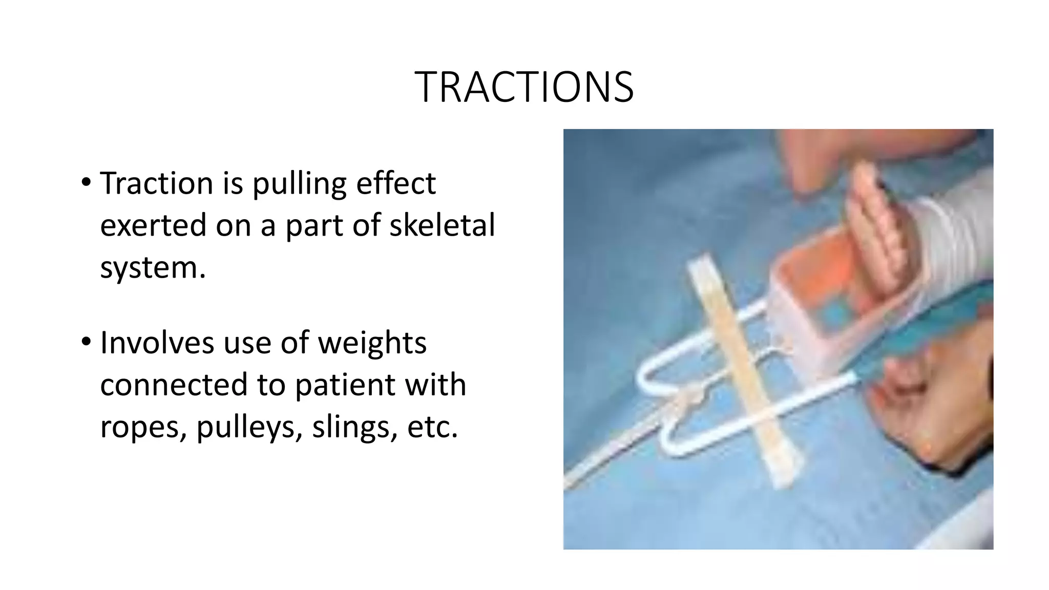 Splints and Tractions | PPTX