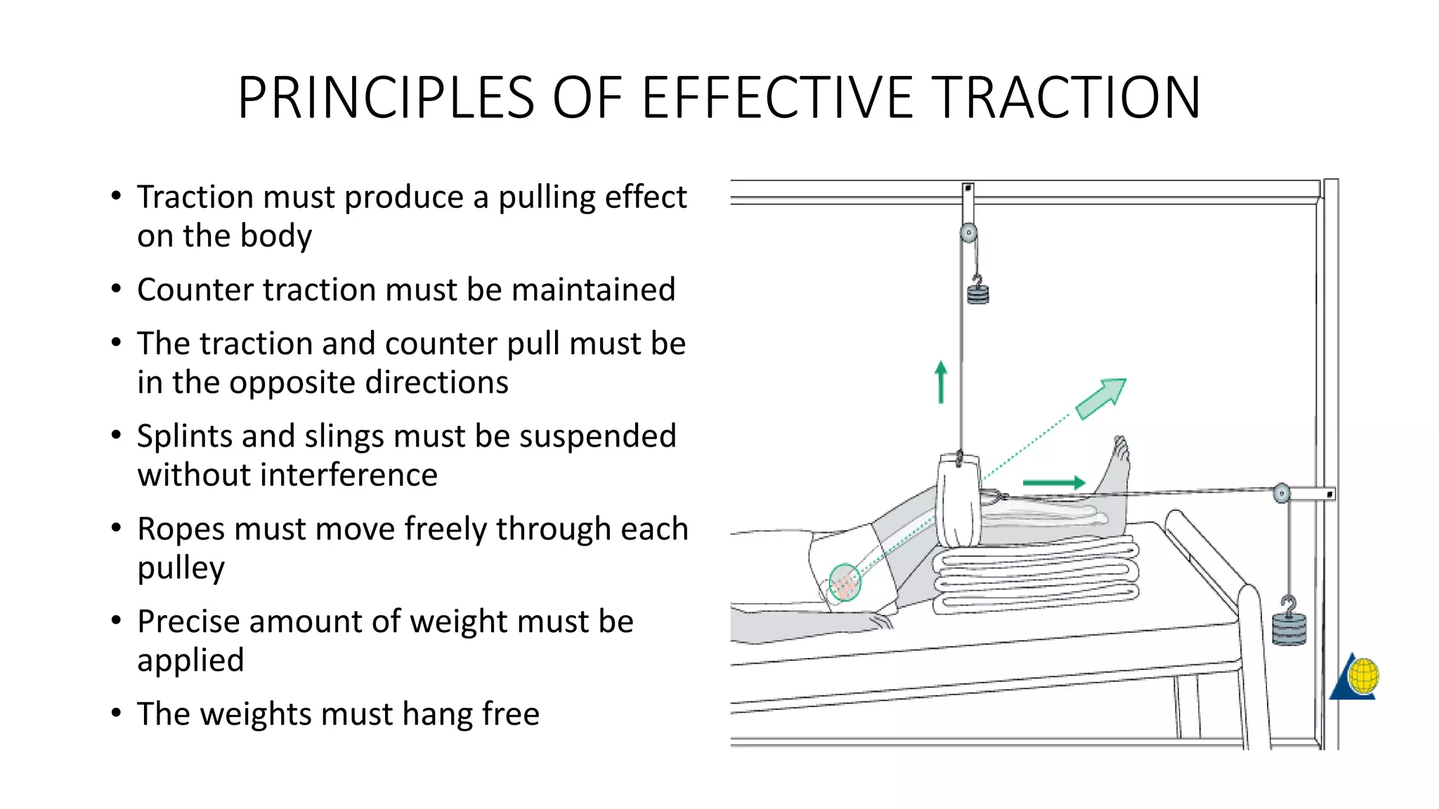 Splints and Tractions | PPTX