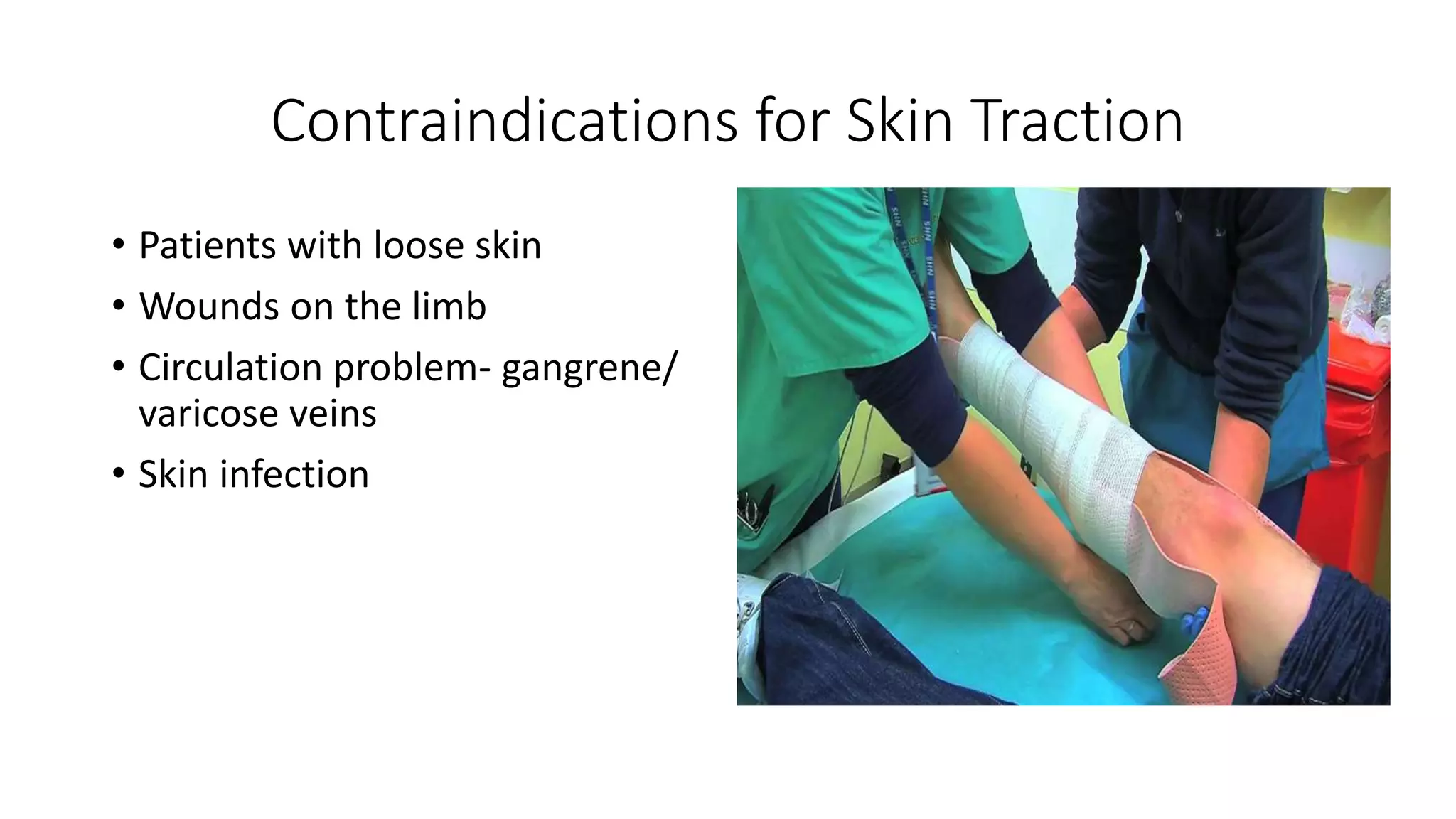 Splints and Tractions | PPTX