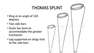 Splints and Tractions | PPTX