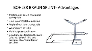 Splints and Tractions | PPTX