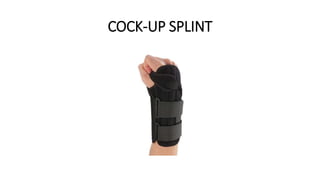 Splints and Tractions | PPTX