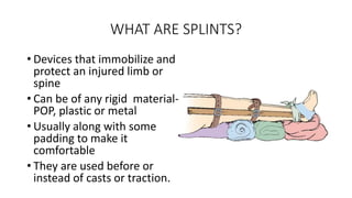 Splints and Tractions | PPTX