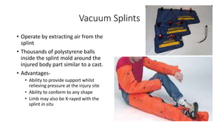 Splints and Tractions | PPTX