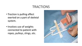 Splints and Tractions | PPTX