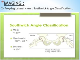 Slipped caital femroal epiphysis (scfe) | PPTX