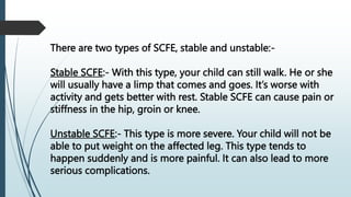 Slipped capital femoral epiphysis .pptx