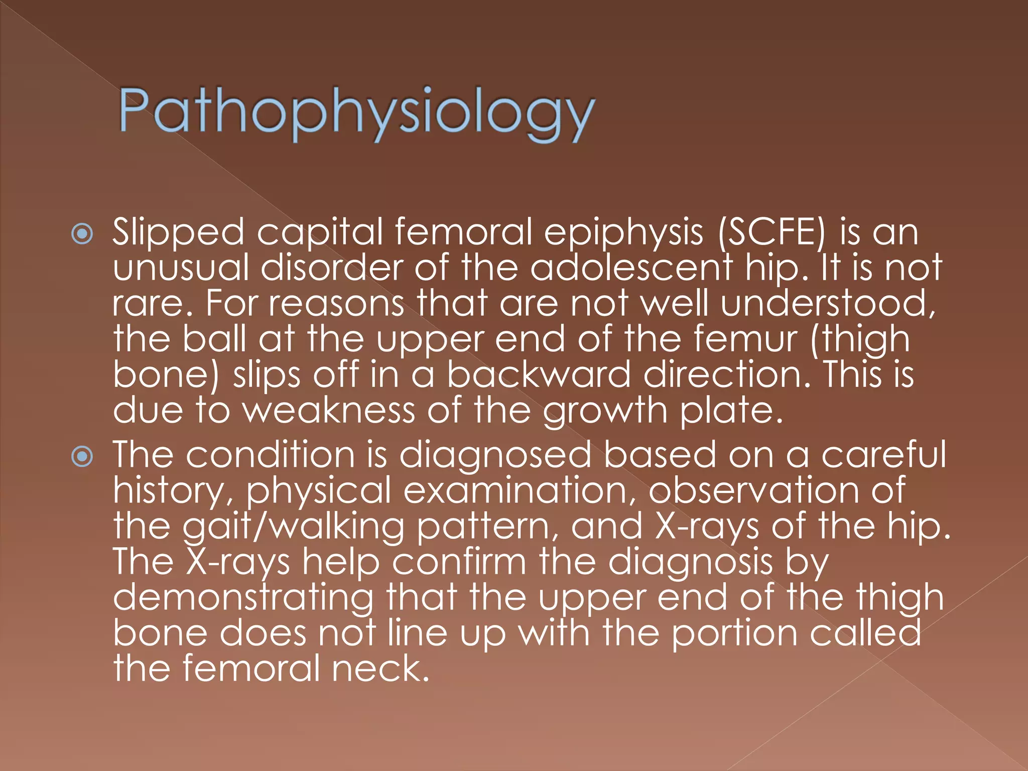 Slipped capital femoral epiphysis | PPT