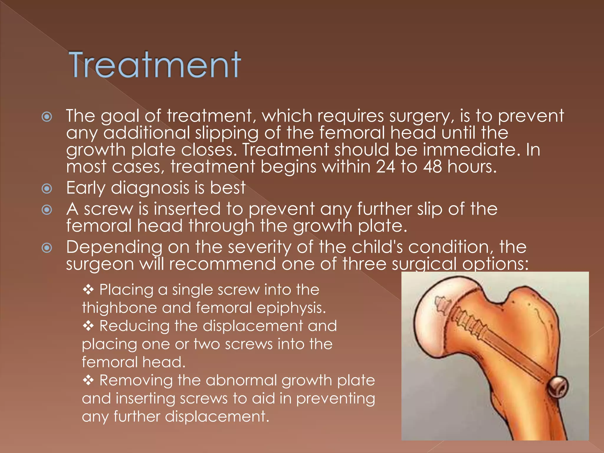 Slipped capital femoral epiphysis | PPT