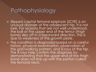 Slipped capital femoral epiphysis | PPT