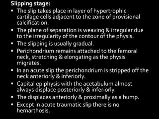 Slipped capital femoral epiphysis | PPT
