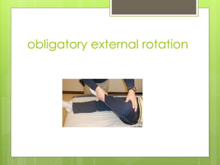 Slipped capital femoral epiphysis | PDF