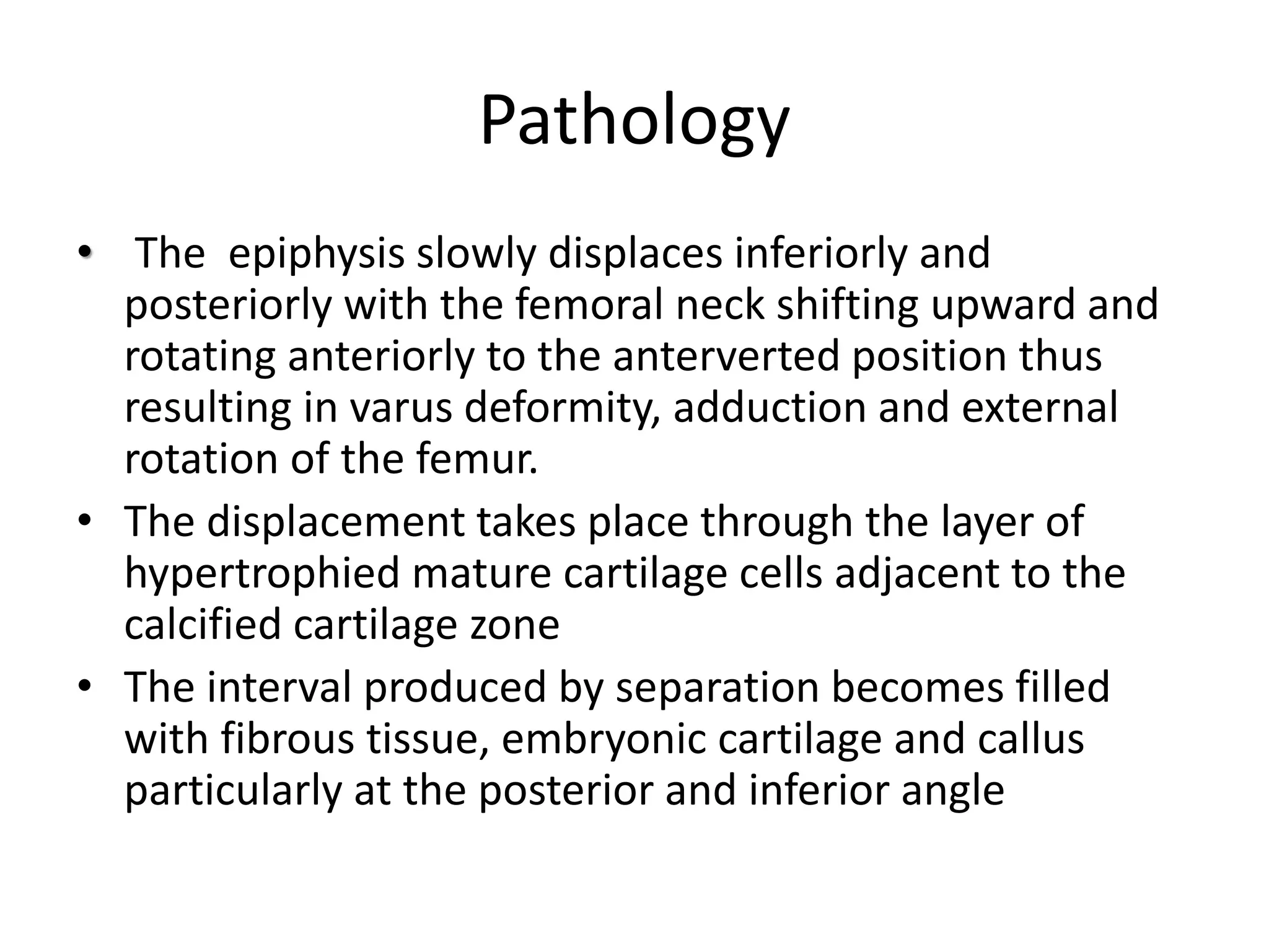 Slipped capital femoral epiphysis | PPTX