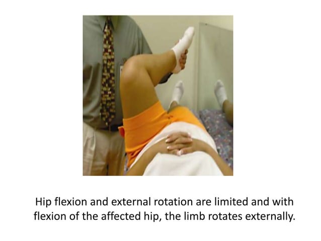 Slipped capital femoral epiphysis | PPTX | Bone and Joint Conditions ...