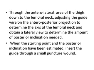 Slipped capital femoral epiphysis | PPTX
