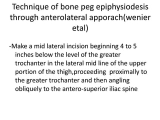 Slipped capital femoral epiphysis | PPTX