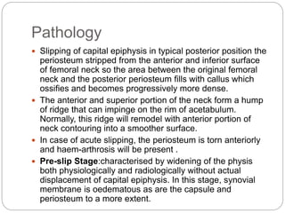 Slipped capital femoral epiphysis | PPTX