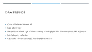 SLIPPED CAPITAL FEMORAL EPIPHYSIS.(SUFE) | PPTX