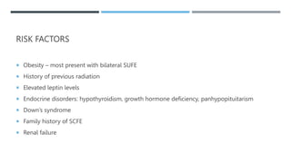 SLIPPED CAPITAL FEMORAL EPIPHYSIS.(SUFE) | PPTX