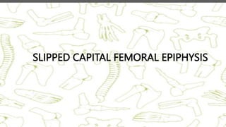 SLIPPED CAPITAL FEMORAL EPIPHYSIS.(SUFE) | PPT