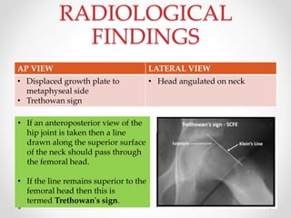Slipped capital femoral epiphysis (scfe) | PPTX