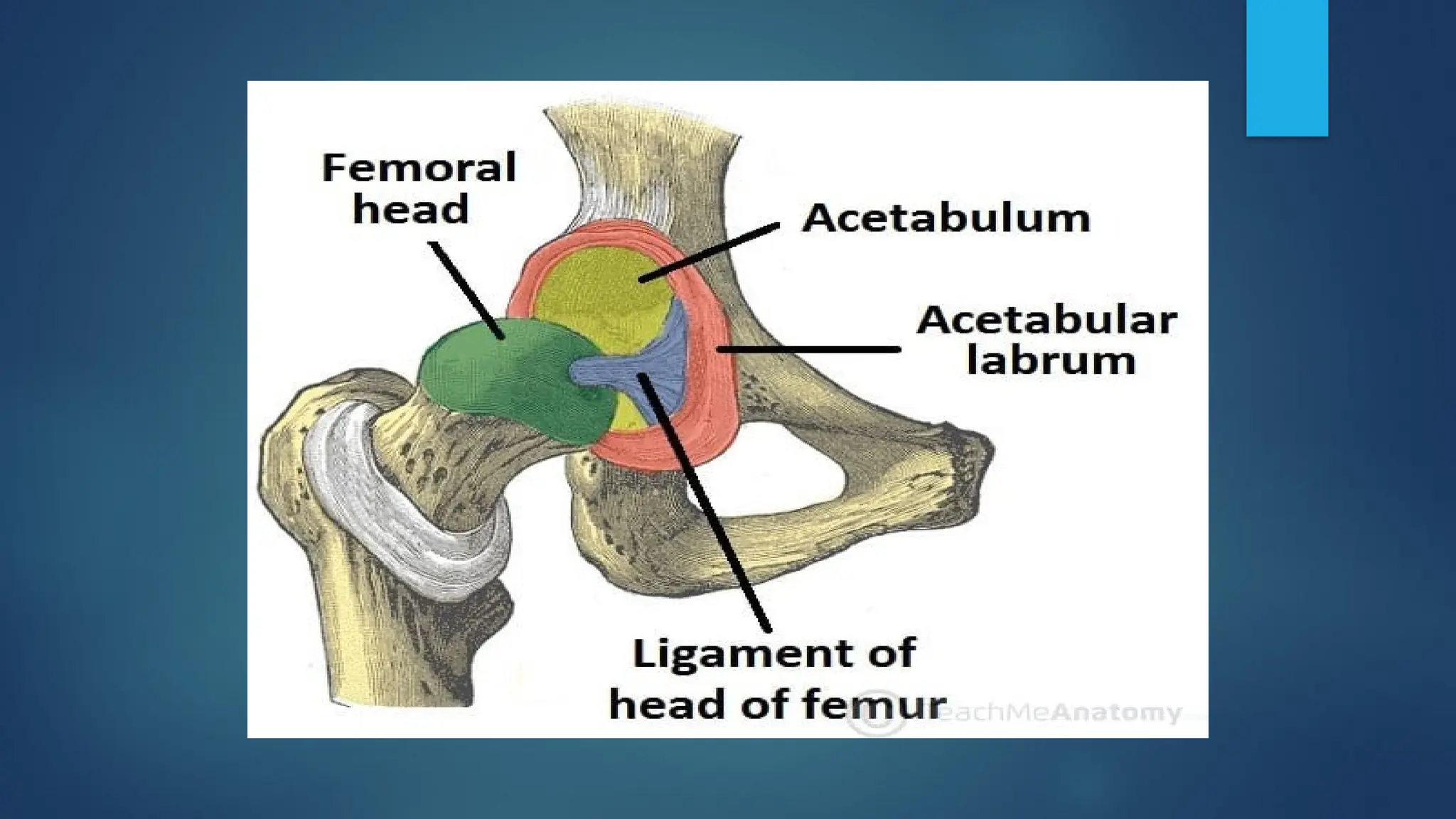 Slipped capital femoral epiphysis (SCFE).pptx
