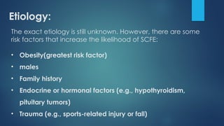 Slipped capital femoral epiphysis (SCFE).pptx