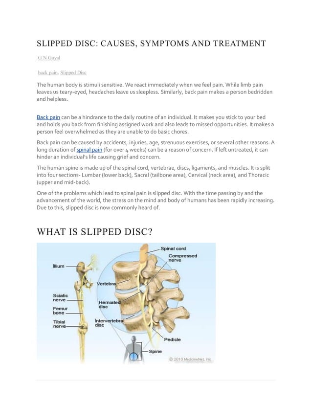 Slipped disc causes, symptoms and treatment. | PDF
