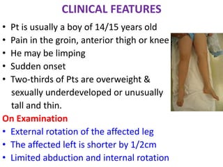 Slipped Upper Femoral Epiphysis (SUFE) | PPTX