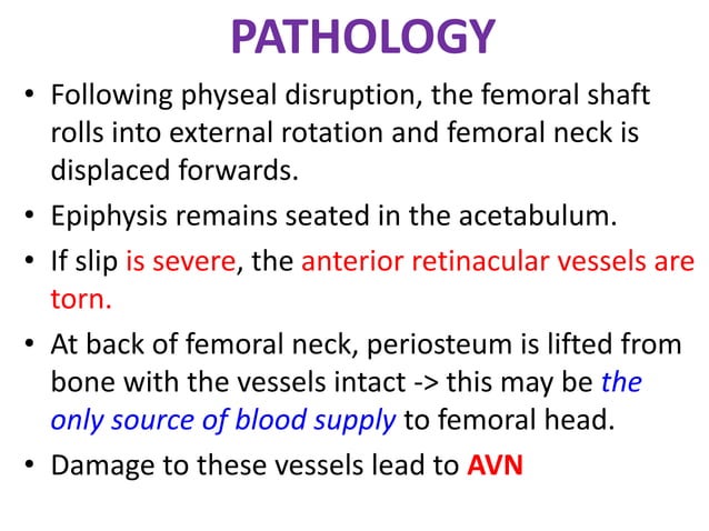 Slipped Upper Femoral Epiphysis (SUFE) | PPTX | Bone and Joint ...