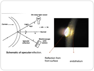 Slit Lamp Diagram