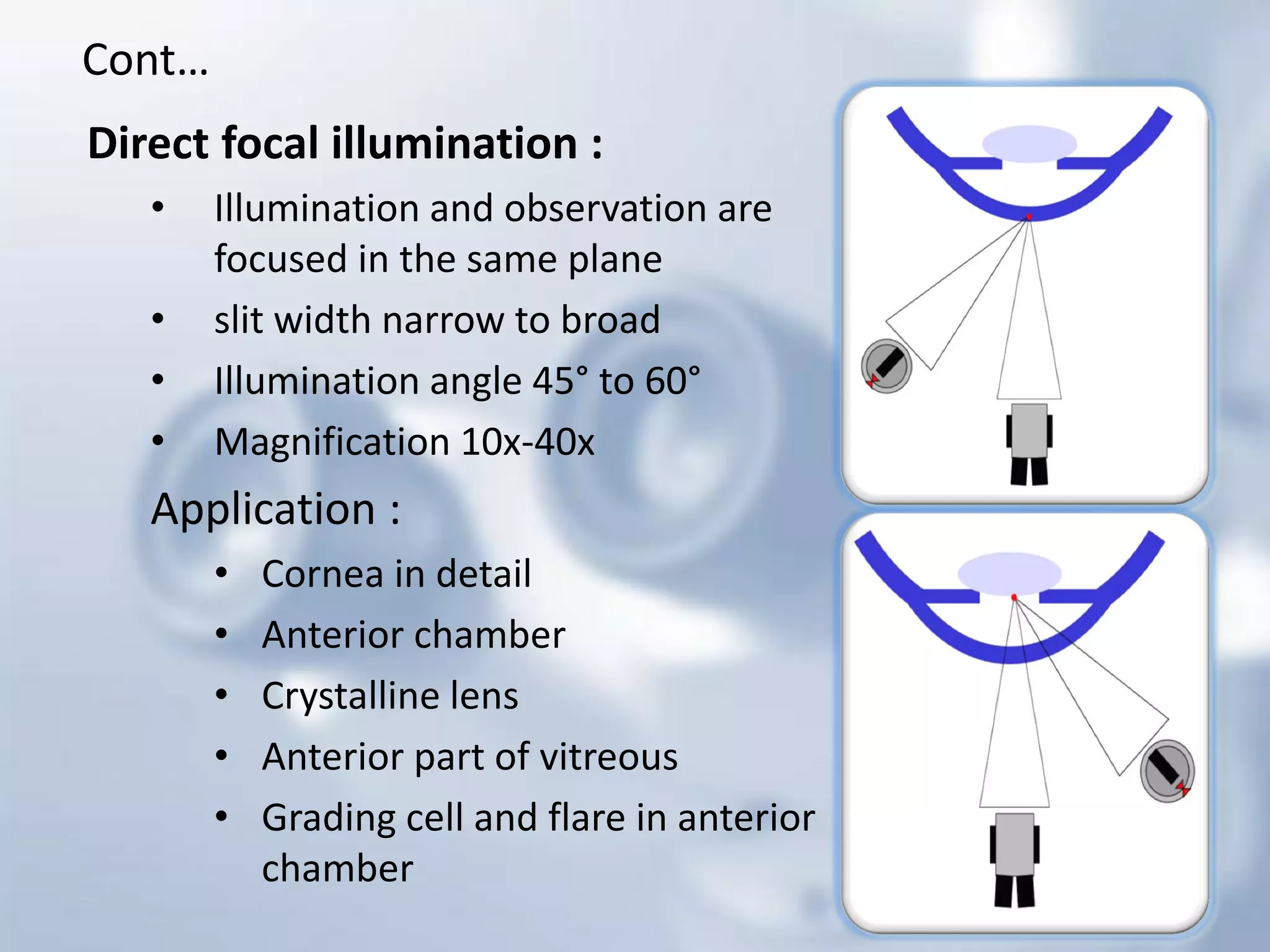Slit lamp biomicroscope | PDF