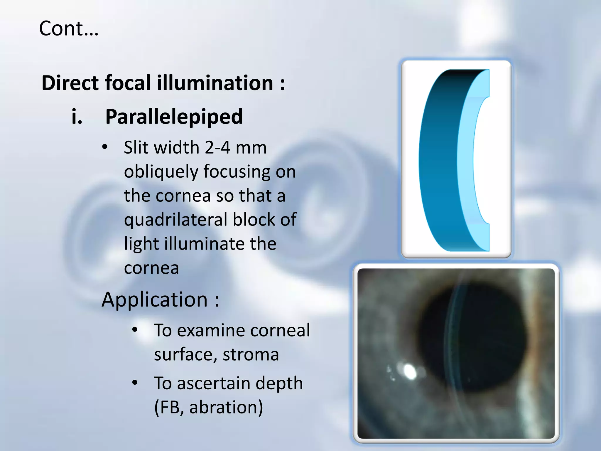 Slit lamp biomicroscope | PPT