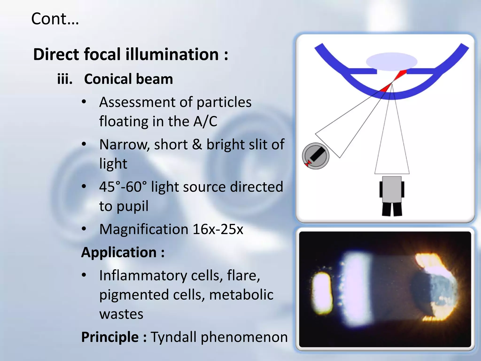Slit lamp biomicroscope | PDF